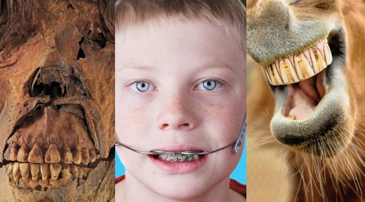 The History of Teeth/ Teeth Through Time
